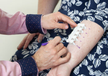 Allergy Testing in Seattle | Skin Allergy Testing | NFM Health